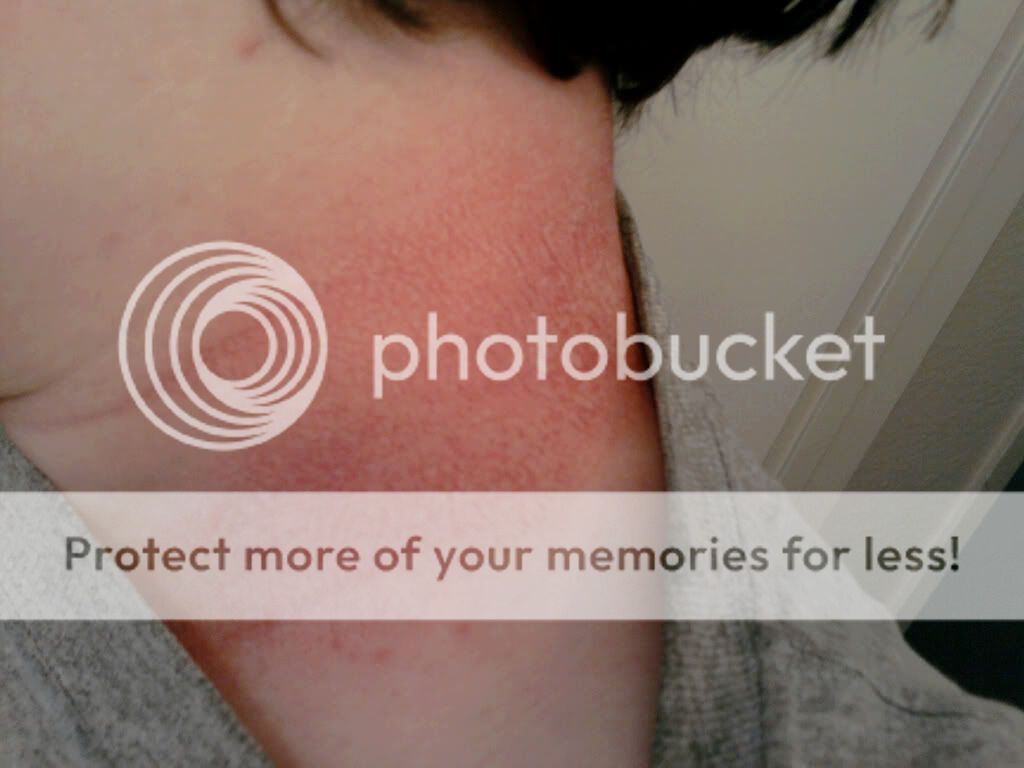 Skin fungus - BabyGaga